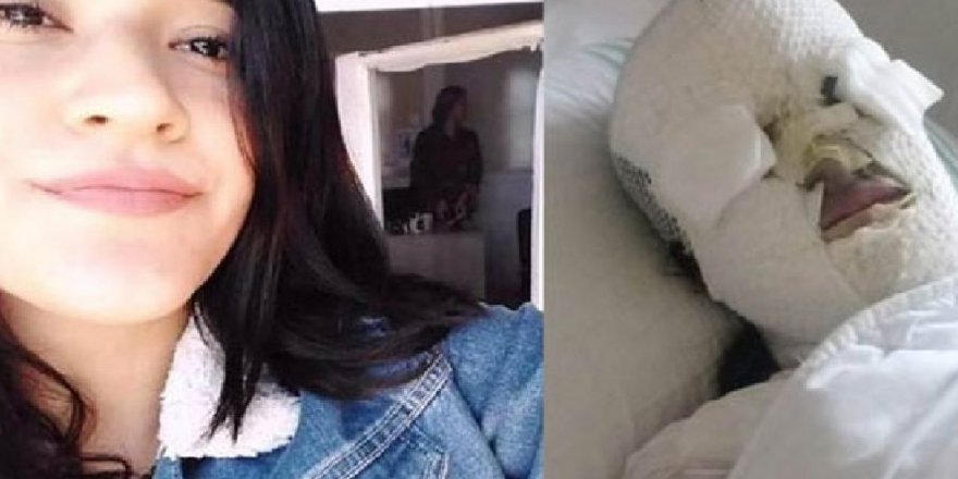 Berfin Özek'e, asitli saldırganı affettiren sebebini, avukatı açıkladı ...